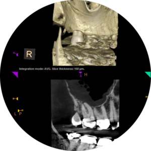 Referring Dentists – Root Canal Specialty Associates