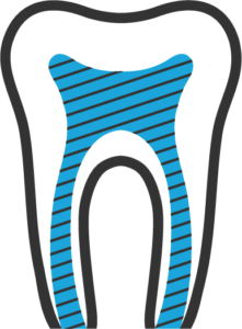 Apexogenesis – Root Canal Specialty Associates